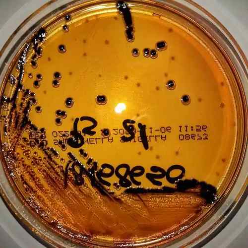 Gélose Salmonella Shigella | Gélose SS