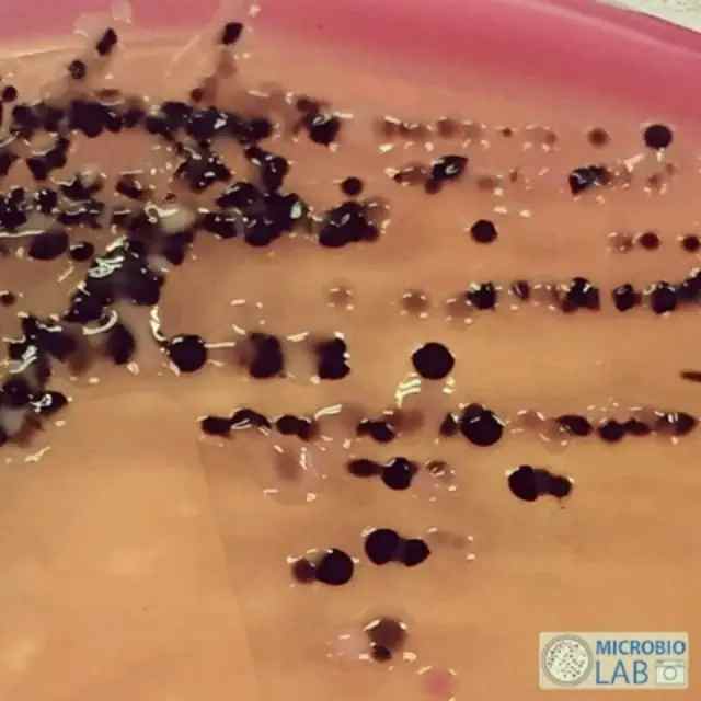 Gélose Salmonella Shigella | Gélose SS